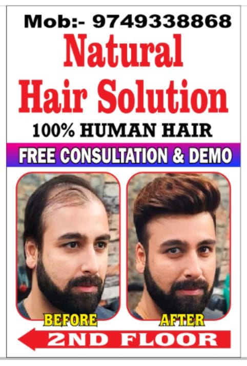 Natural Hair Solution Rourkela | Hair Patches, Wigs & Extensions